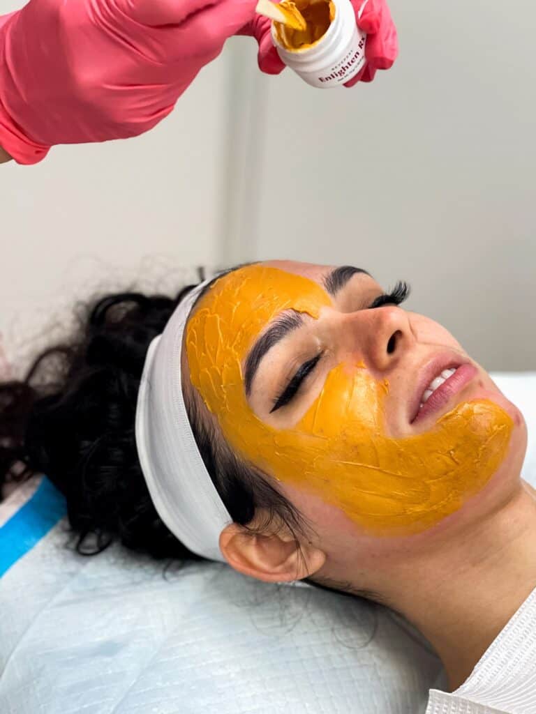 Le Beauty Med Spa Dallas Acne Skin Transformation - My Curly Adventures